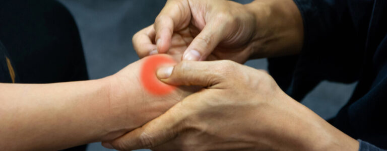 How Dry Needling for Trigger Points Works